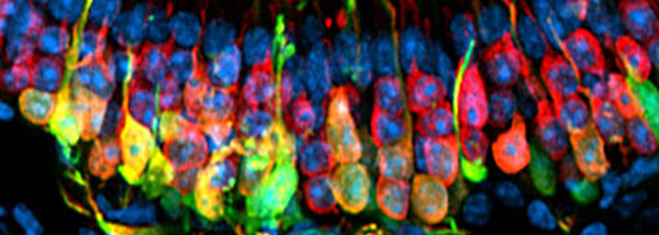 Society for Hematopathology